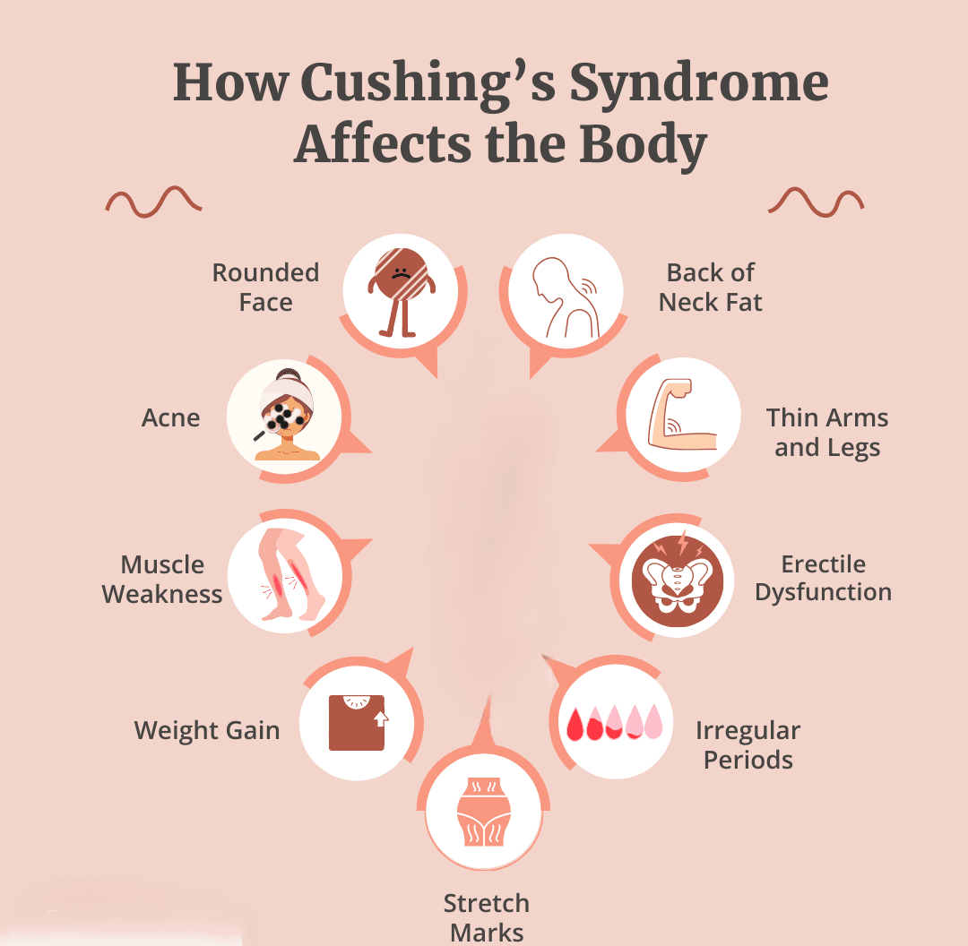 Ayurvedic Treatment for Cushing Syndrome